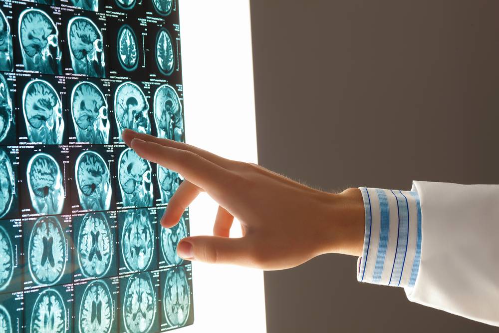 Can You File a Lawsuit for a Fatal Brain Injury? | Morelli Law