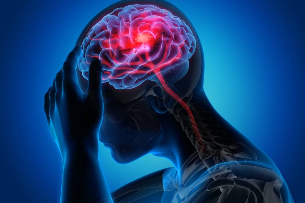 Statute of Limitations for Brain Injury Claims | Morelli Law