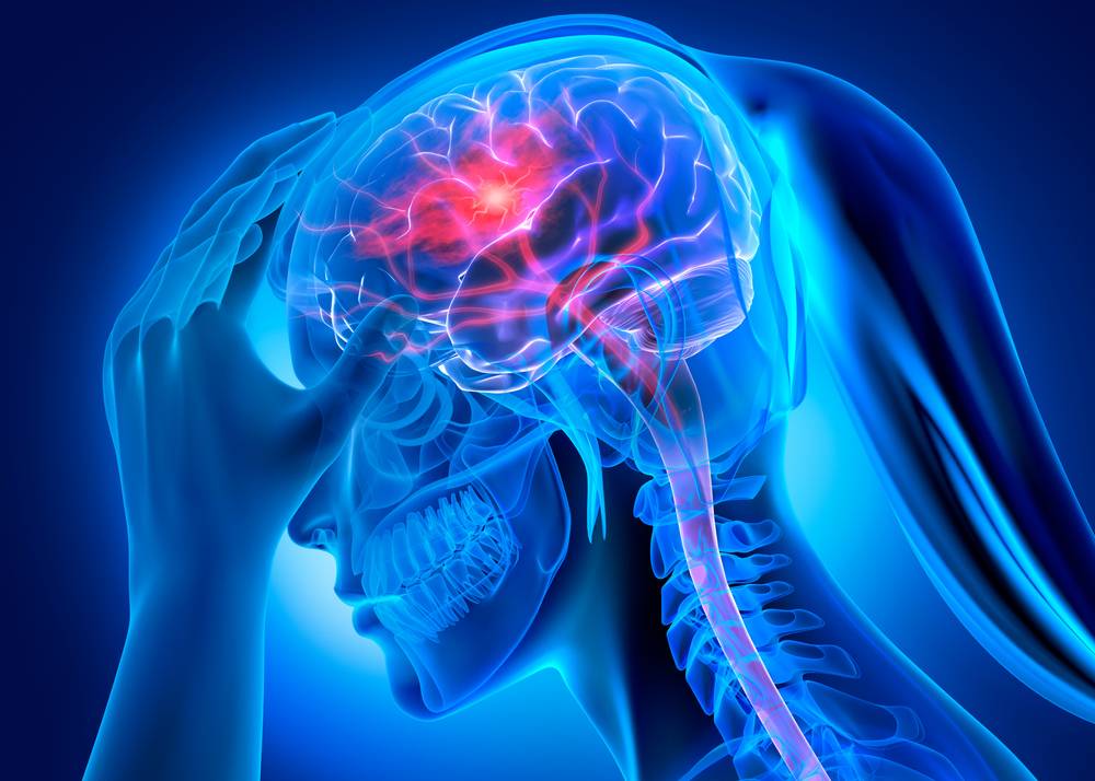 What to Bring to Your Consultation With a Brain Injury Lawyer